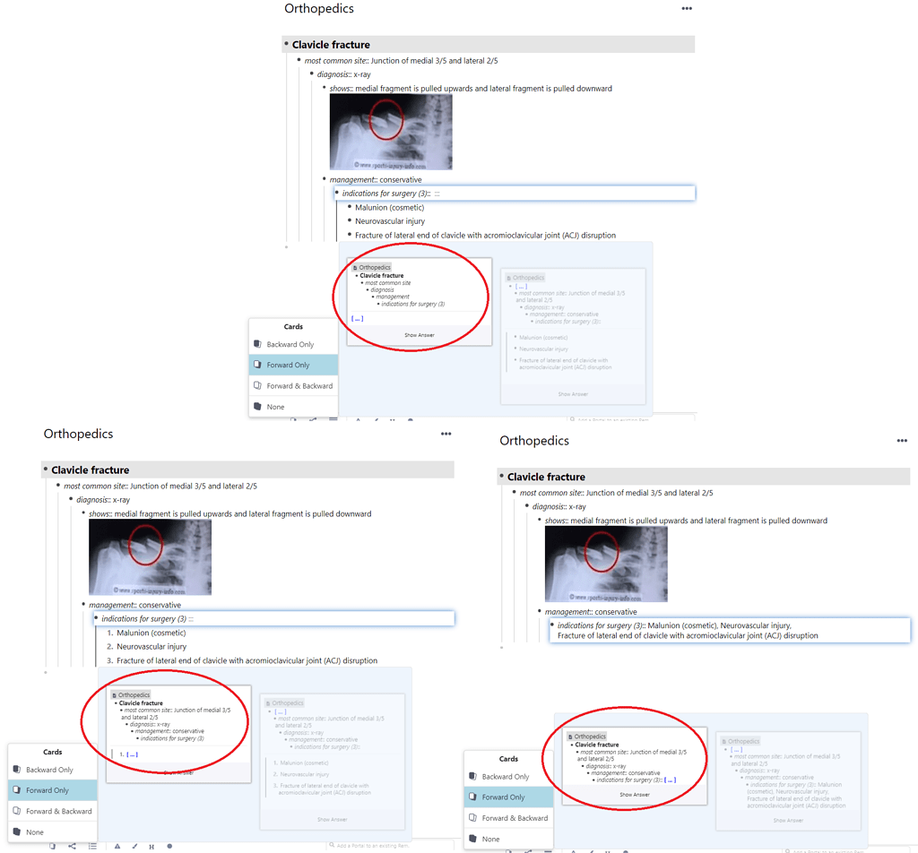 Problem with multiple lines flashcards - Learning RemNote - RemNote